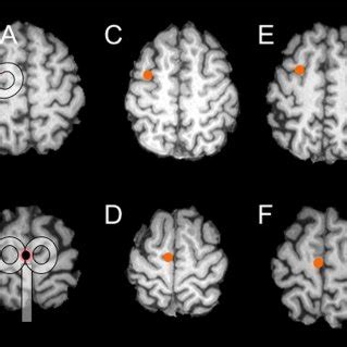 Reconstructed TMS Sites From 3 Participants Stimulation Sites Over The Download Scientific