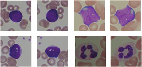 image result after the data augmentation technique download