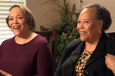 Conjoined Twins Separated In 1955 Open Up About Historic Surgery