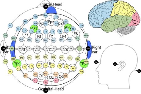 Understanding The Strategic Placement Of Sensors On Eeg Devices Naxon