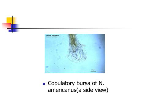 Parasitology Hookworm Pptx Slides 1 Ppt