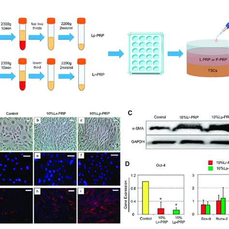 Effects Of Leukocyte Rich Platelet Rich Plasma Lr Prp And