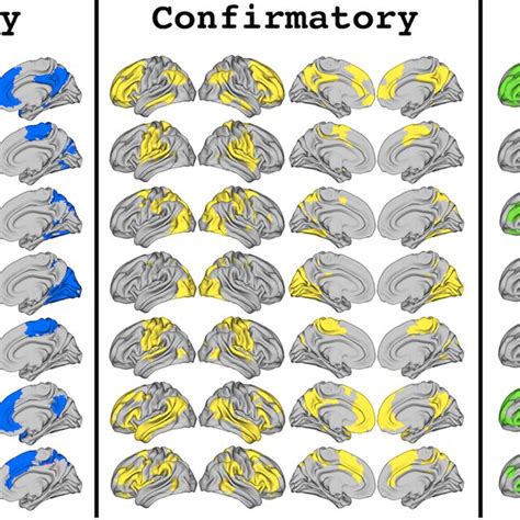 Visualization Of Nonoverlapping Network Topographies That Significantly