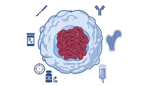 Susan Song On Linkedin 🎉 Newly Published Review Targeting Myc Driven Lymphoma Lessons Learned…