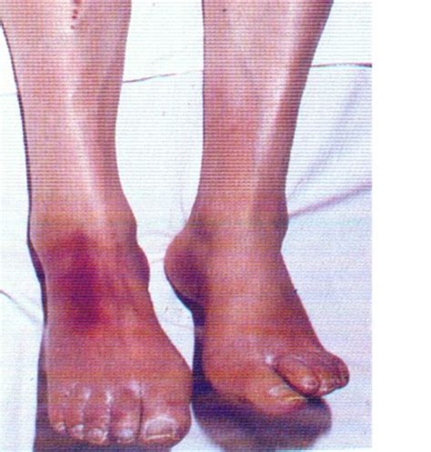 Angiography Flashcards Quizlet