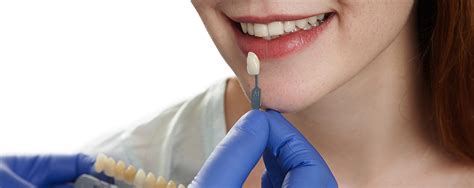 치아미백 강남레옹치과