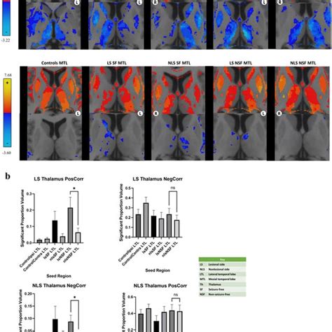 Positive And Negative Temporal Lobe Connectivity In Healthy Controls