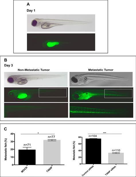 Regulatory Effects Of Txnip On Metastatic Ability Of Hcc Cells In