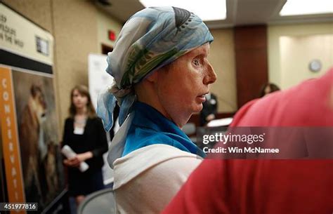 Charla Nash Photos And Premium High Res Pictures Getty Images