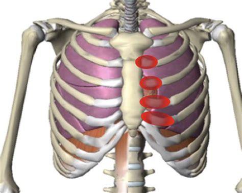 Costochondritis And Chest Wall Pain Rib Injury Clinic