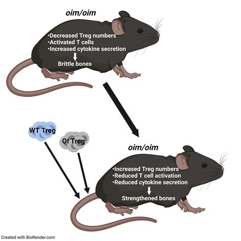 Treg Cell Transplantation Proves Effective In Treating Brittle Bone Disease In Mouse Model