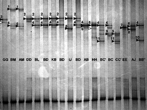 Double Strand Pcr Single Strand Conformation Polymorphism Analysis Of Download Scientific
