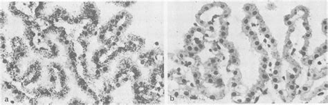 Radioautographs Of The Rat Choroid Plexus After A Injection Of Download Scientific Diagram