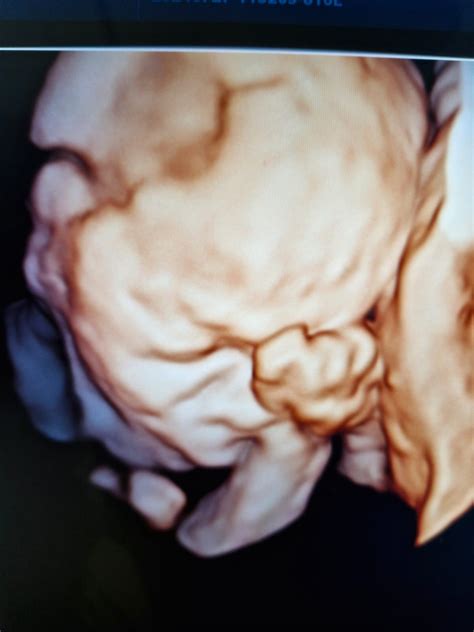 Anomaly Scan The Doctors Diagnostics