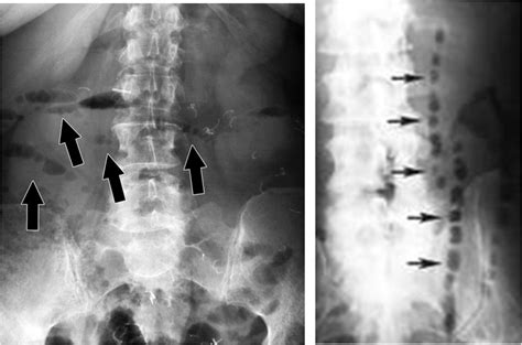 Dr Herry Setya Yudha Utama Spb Finacs Mhkes Ics Digestive Surgery