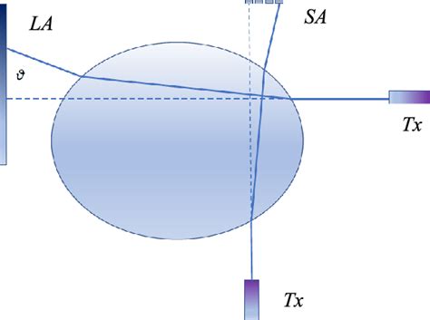 Figure 1 From Large Area Pyroelectric Based Differential Detector For Medical Ultrasound