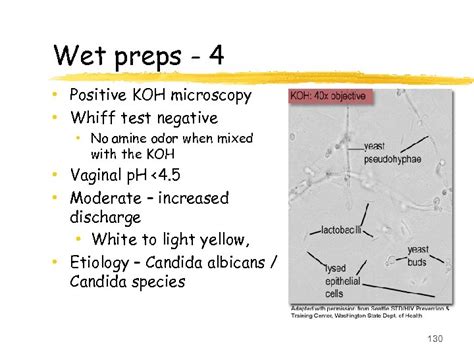 Urinalysis And Body Fluids Unit 5 Seminal Fluid