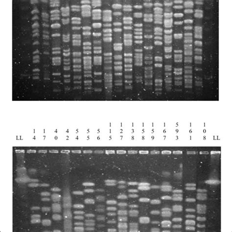 Pfge Fingerprinting Of Xbai Digested Dna From Esbl Positive E Coli