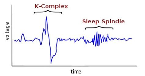 Sleep Spindles