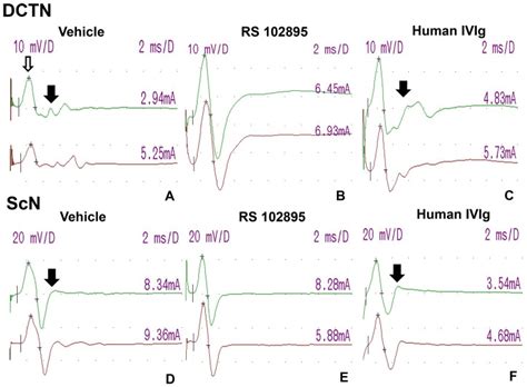 Digital Motor Nerve Conduction Waveforms From Vehicle Ccr2 Inhibitor