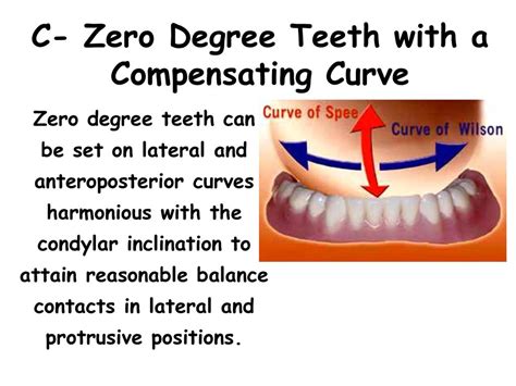 COMPLETE DENTURE OCCLUSION Ppt Download