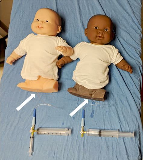 Voiding Urosonography Phantoms Catheters Are Placed In The Urethra Download Scientific Diagram