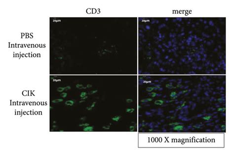 The Immunofluorescence Staining Of Tumors Collected From Different