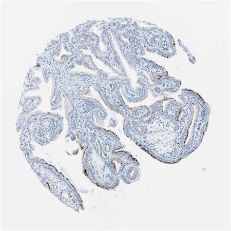 Tissue Expression Of Afp Staining In Gallbladder The Human Protein