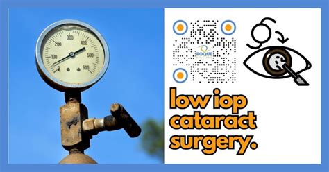 Capsule Tension Ring How This Tiny Ring Protects Your Vision After Cataract Surgery