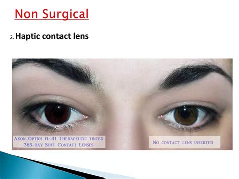 Ptosis Pptx