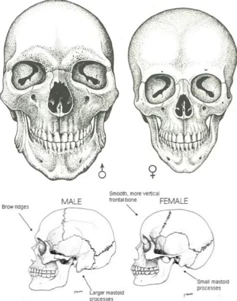 Larger Mastoid Processe5 Ifunny