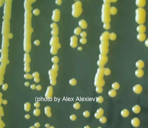 Arthrobacter Alchetron The Free Social Encyclopedia