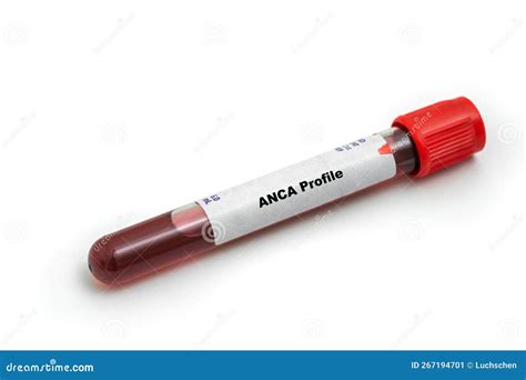 Anca Profile Medical Check Up Test Tube With Biological Sample Stock