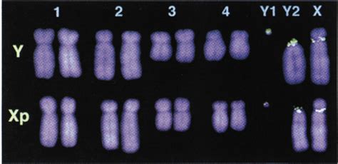 Fluorescence In Situ Hybridization With Biotin Labeled Dna From Download Scientific Diagram