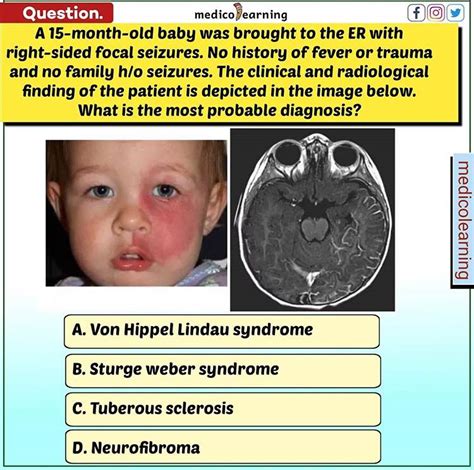 Photo Credit On Photo Ophthalmology Notes And Synopses