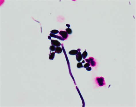 Yeast Object Detection Dataset By Yeast