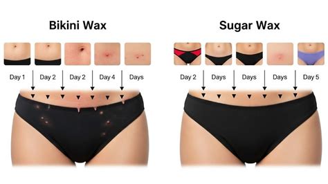 Bikini Wax Vs Sugar Wax Recovery Comparison Explained Blushed Beauty