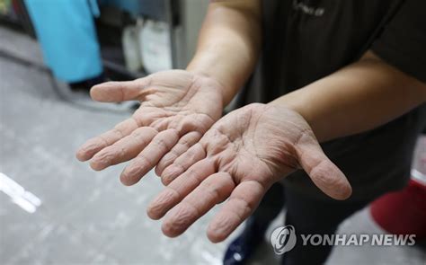 고무장갑을 벗으니 땀에 손이 쭈글쭈글 연합뉴스