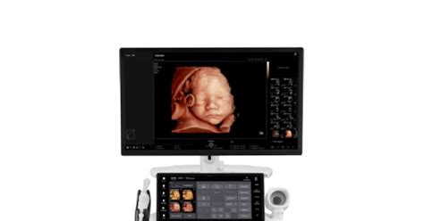 삼성메디슨 국내 학술대회서 프리미엄 초음파 진단기기 `헤라 Z20` 선보인다