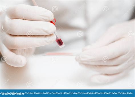 Laboratory Assistant Holds Test Tube Close Up For Gynecological And Cytological Analysis Woman