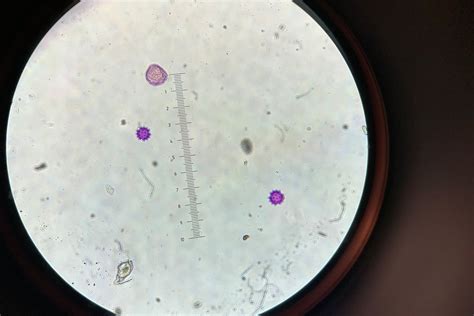 From The Jha Lab Using Pollen To Solve Crime Biodiversity Center
