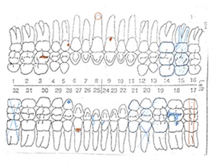 Dental Charting Symbols A Standardized Uniform And Universal Dental