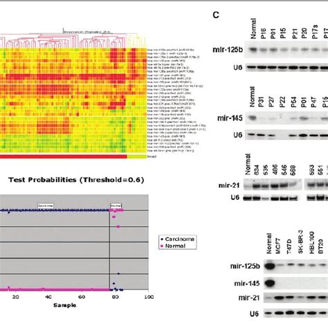 cluster analysis and pam prediction in breast cancer and normal breast