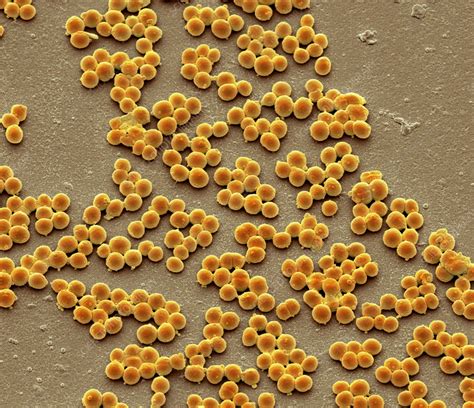 Streptococcus Group A Under A Microscope