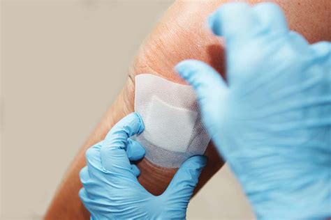 Wound Healing Patch Of Blue Green Algae Mends Skin Quickly New Scientist