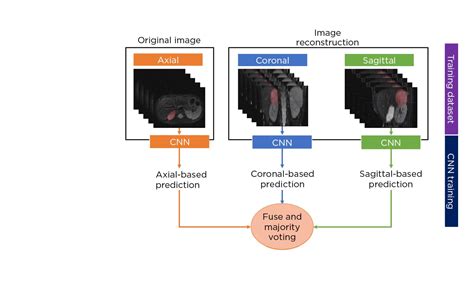 Fully Automated Segmentation Of Neuroblastic Tumours On Multisequence Mri Using Convolutional