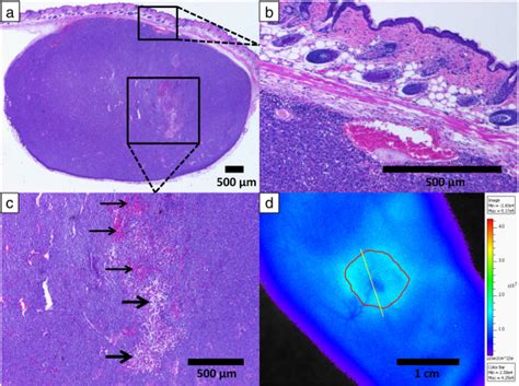Hande Stain And Cli Of A 21 Day Post Injection Fibrosarcoma Tumor A Download Scientific