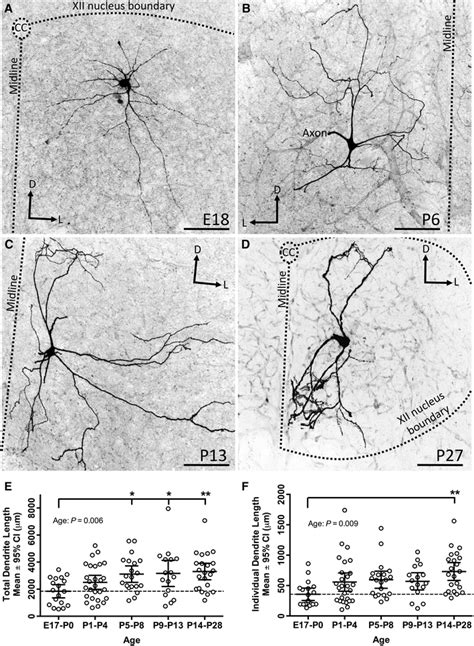 Dendritic Length Increases During Postnatal Development Ad Low Power