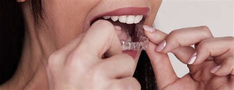 Can You Use Invisalign With Missing Teeth Heres What You Need To Know