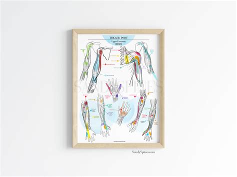 Trigger Point Charts Set Of 3 Posters Sandyspines